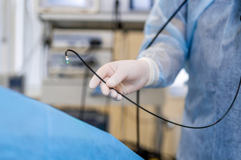 Endoscopía y Colonoscopía - Clínica Andes Salud Concepción